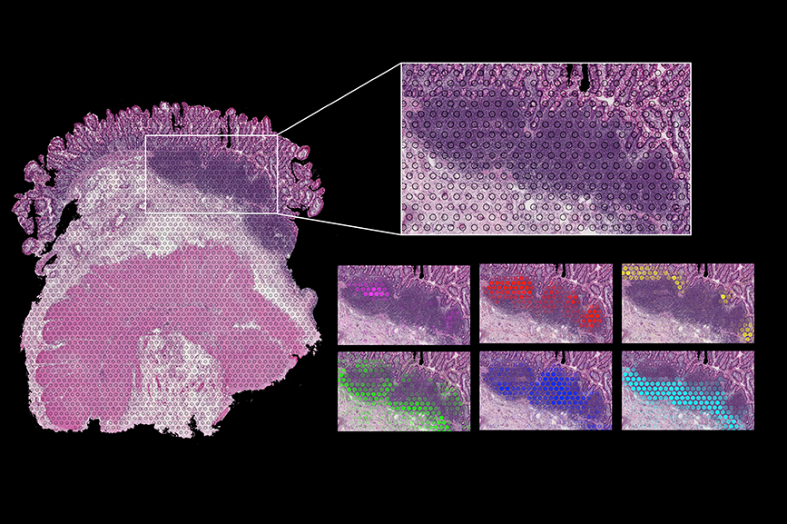 Teknik för kartläggning av genaktivitet i vävnad årets metod i Nature ...