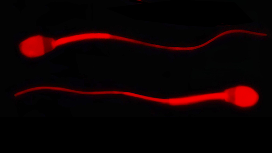 Non-hormonal gel proves effective at helping mucus block sperm | KTH