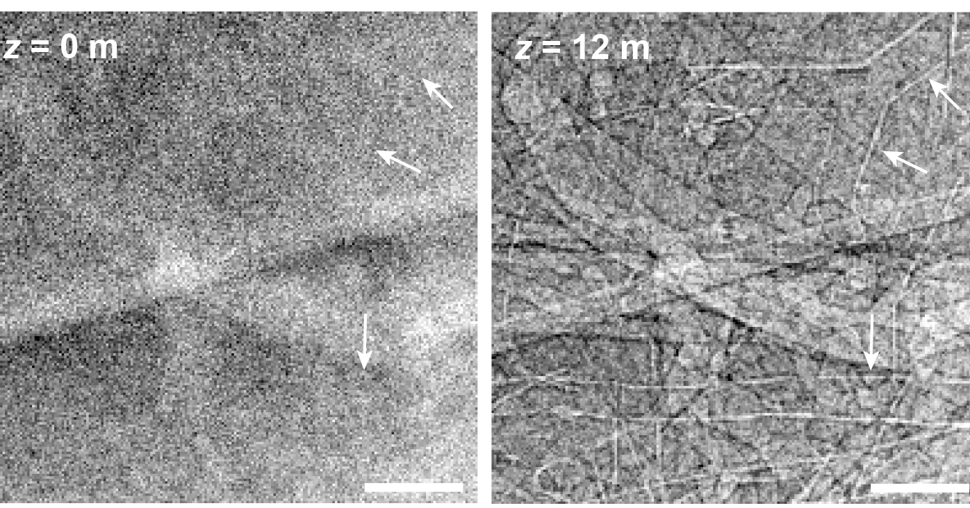 Advanced imaging tech could be used to detect early-stage lung disease ...