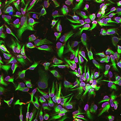 Device improves stem cell generation and chances for personalized cell ...