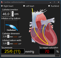 PC-based real-time simulation of cardiovascular physiology | KTH