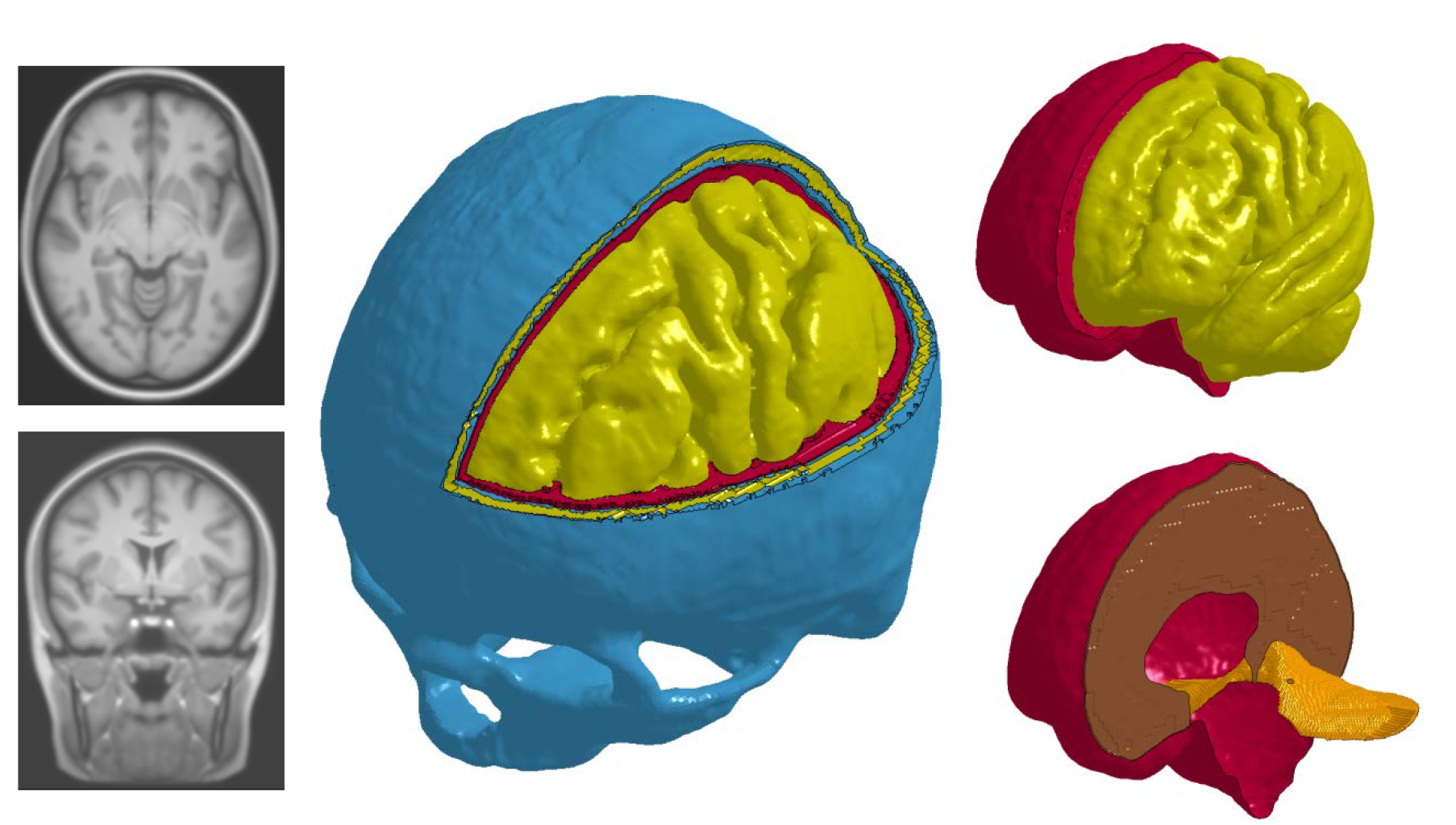 The aging brain | KTH